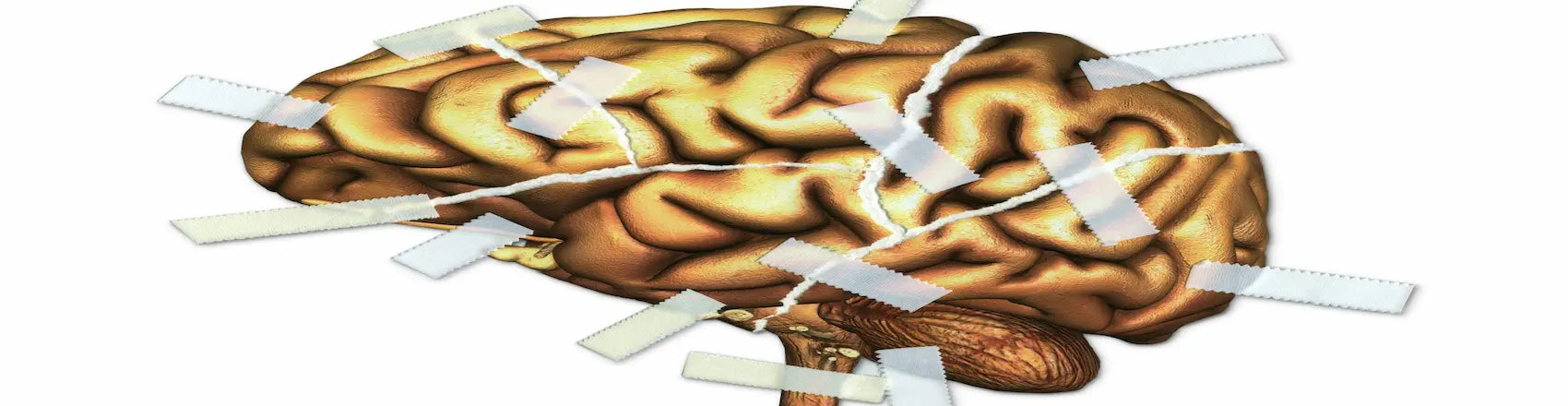 Nicotinamide Riboside Repaired Brain Damage and Improves Memory – Renue ...